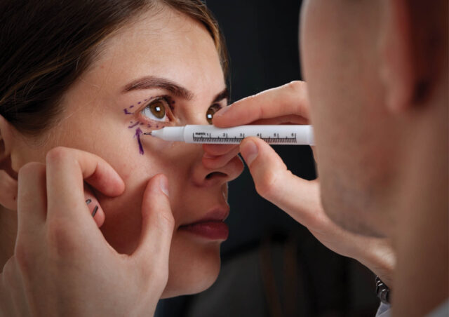 Oculoplasty & Aesthetic Eye Care – Solis Eye Care