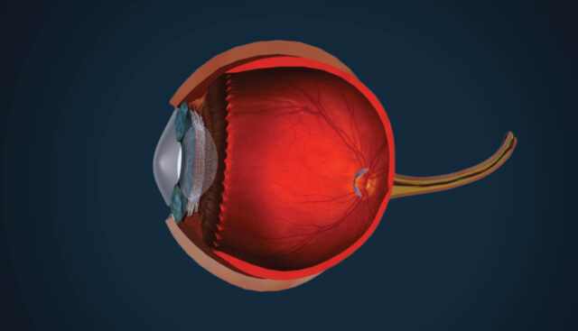 Uvea - Solis Eye Care